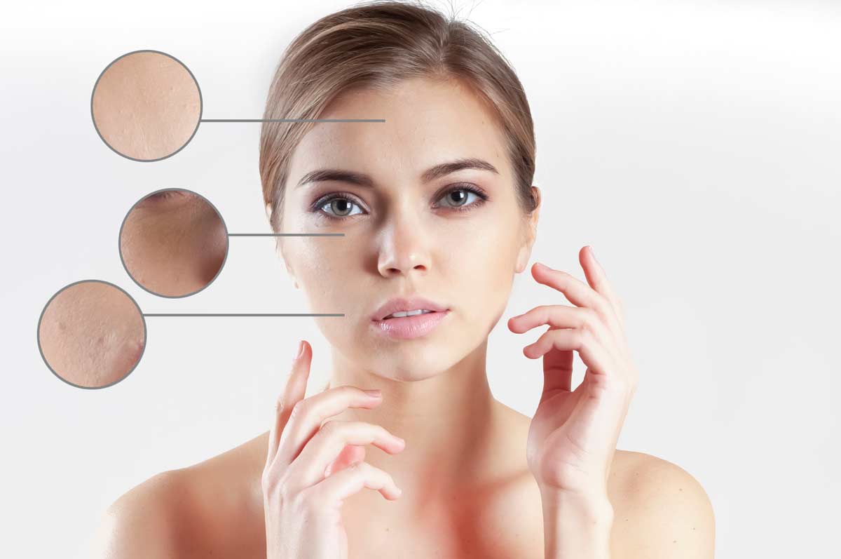 Causes and ways to treat facial skin wrinkles - ویرگول